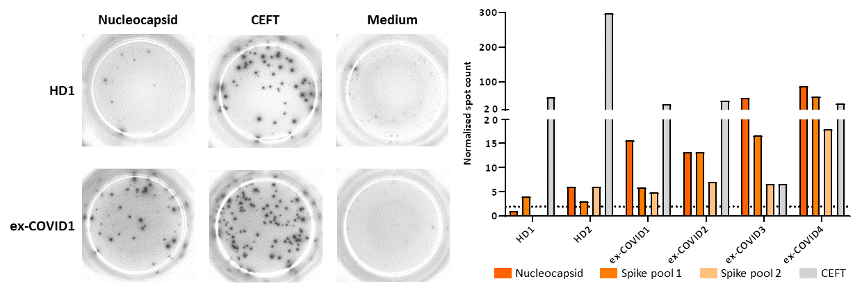 Cytokine analysis - ELIspot