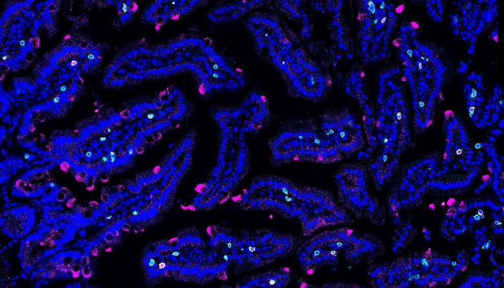 Unraveling how tissue-resident memory T cells arise